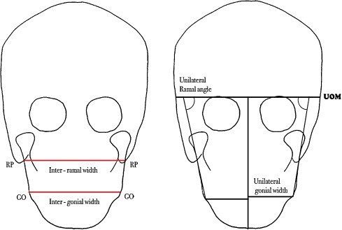 How to actually fix recessed chin without surgery | Looksmax.org - Men ...