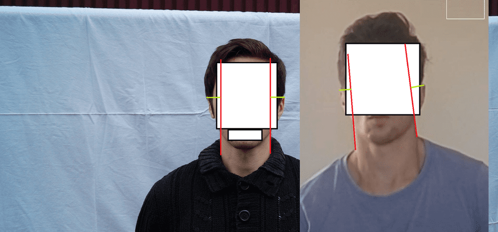 My 1 year neck training experience | Looksmax - Men's Self-Improvement ...
