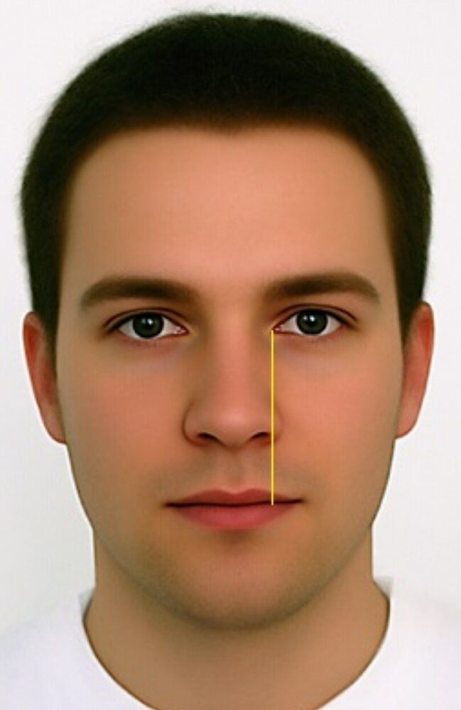 Midface length of male models? | Looksmax - Men's Self-Improvement ...