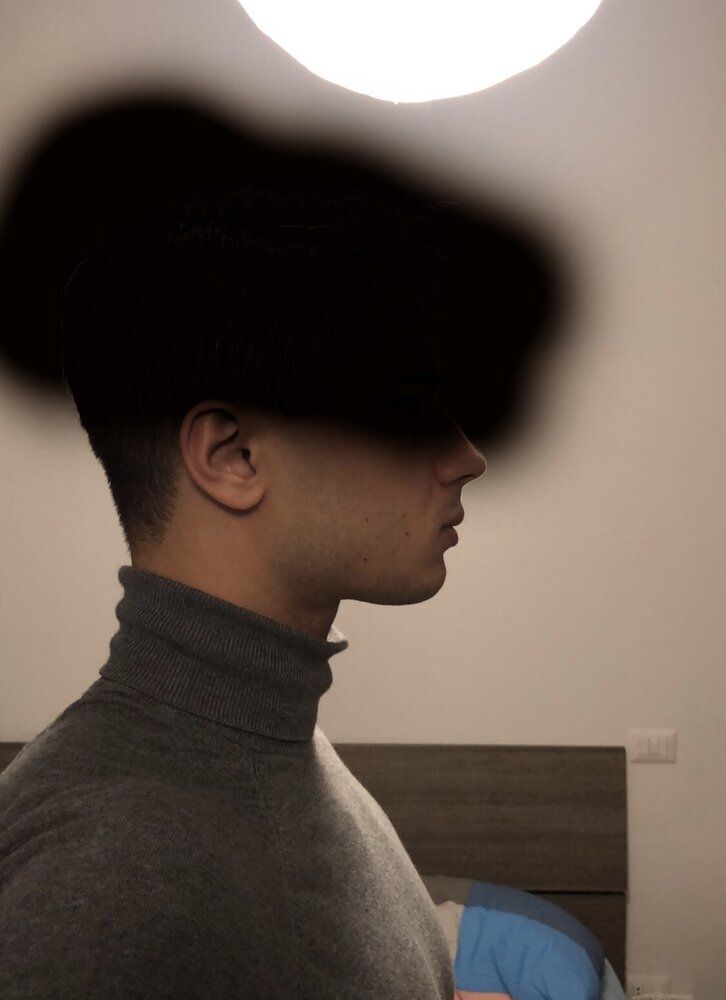 What surgery would achieve this result? (Pics with morph inside ...