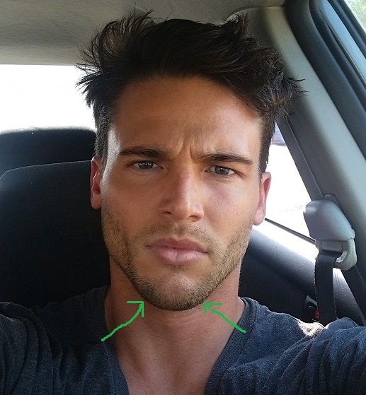 If I want nothing but to change the shape of my chin from round to ...