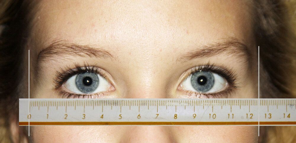 The importance of temple width | Looksmax.org - Men's Self-Improvement ...