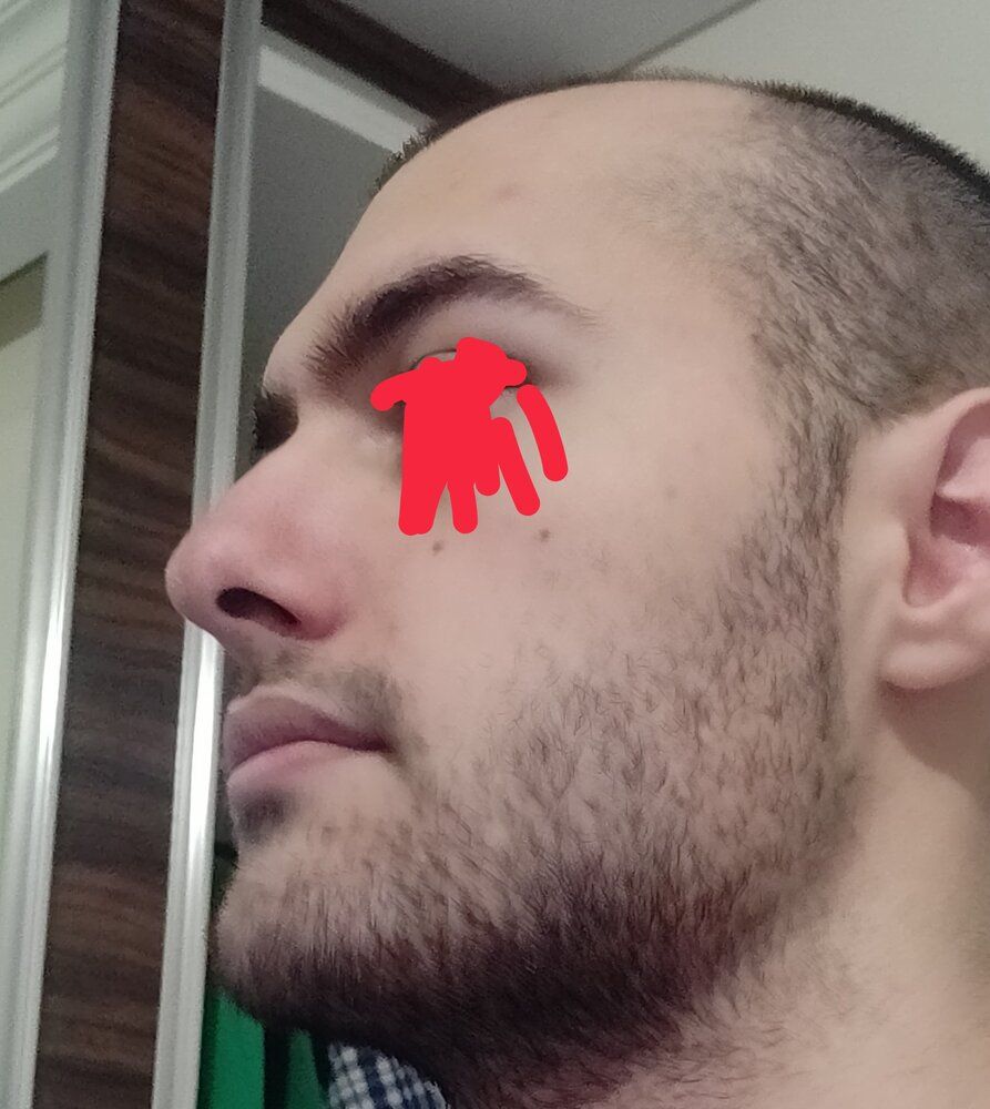 Post examples of low tier normies | Looksmax - Men's Self-Improvement ...