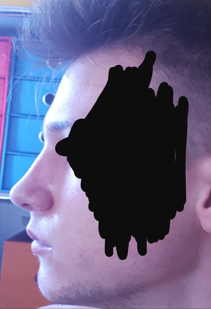 Is my face recessed at all? | Looksmax.org - Men's Self-Improvement ...