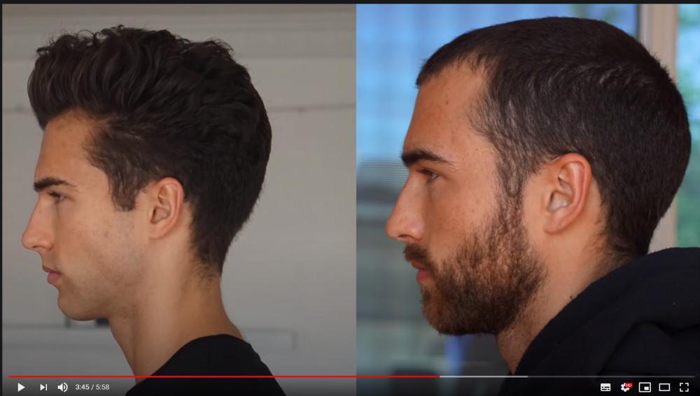 Reminder That Your Maxilla Is Everything | Looksmax - Men's Self ...
