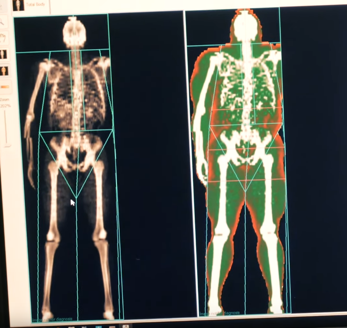 muh I'm a framelet, muh gymcelling is cope | Looksmax.org - Men's Self ...