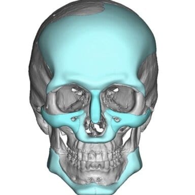 Dimorphism >>>> looks ? | Looksmax.org - Men's Self-Improvement ...