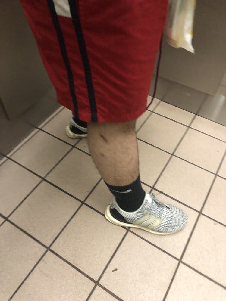 Why Are My Legs So Thick And How Do I Get Em Smaller Looksmax