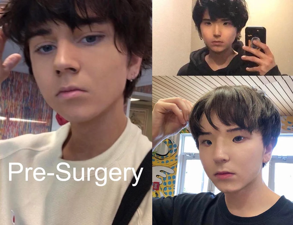 Mirin Asianmaxxer? | Looksmax.org - Men's Self-Improvement & Aesthetics