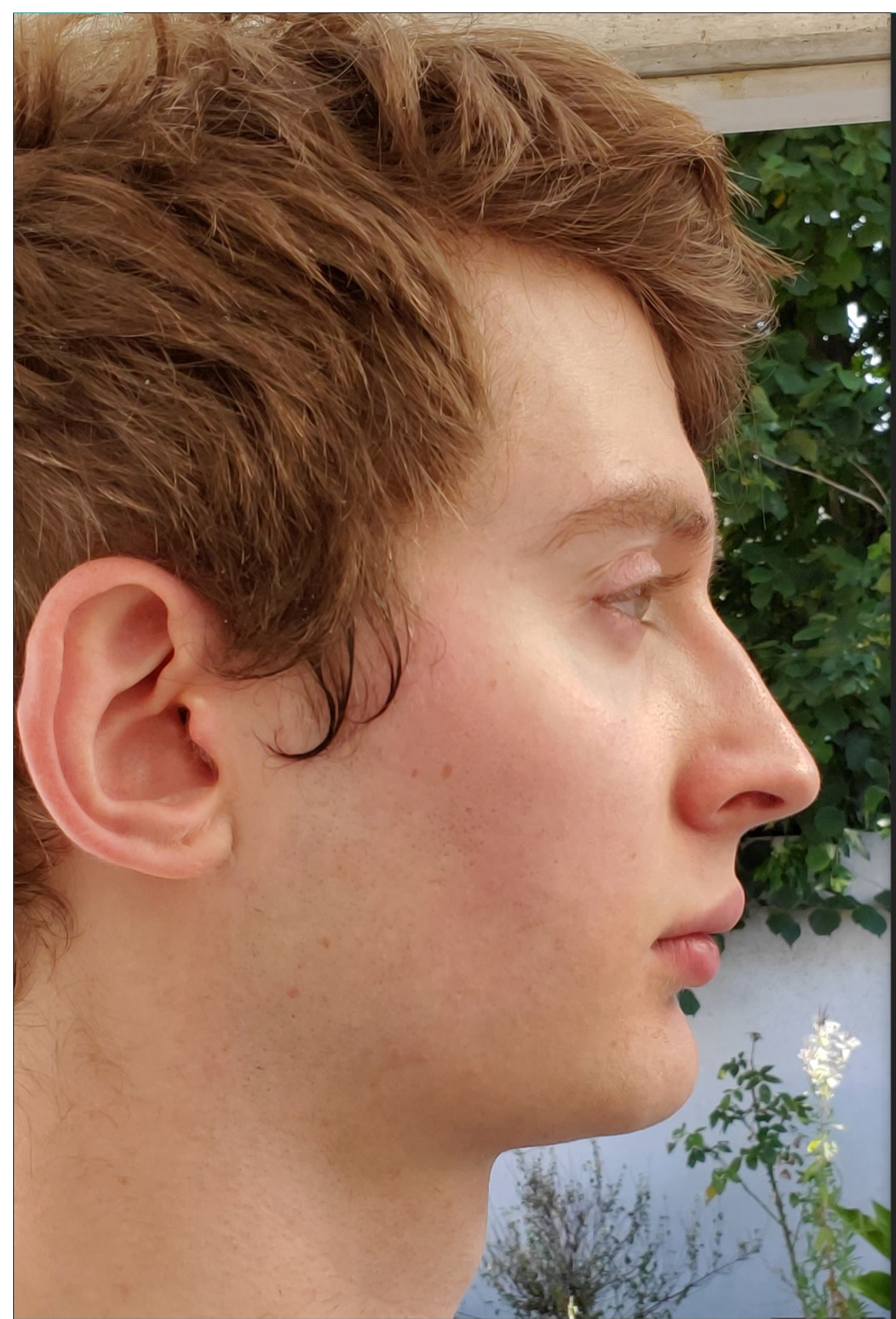 Is a concave philtrum a feminine trait? | Looksmax.org - Men's Self ...