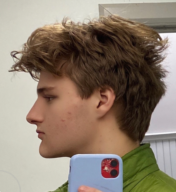 Rate my side profile | Looksmax.org - Men's Self-Improvement & Aesthetics