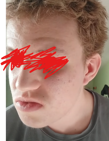 rate my side profile | Looksmax.org - Men's Self-Improvement & Aesthetics