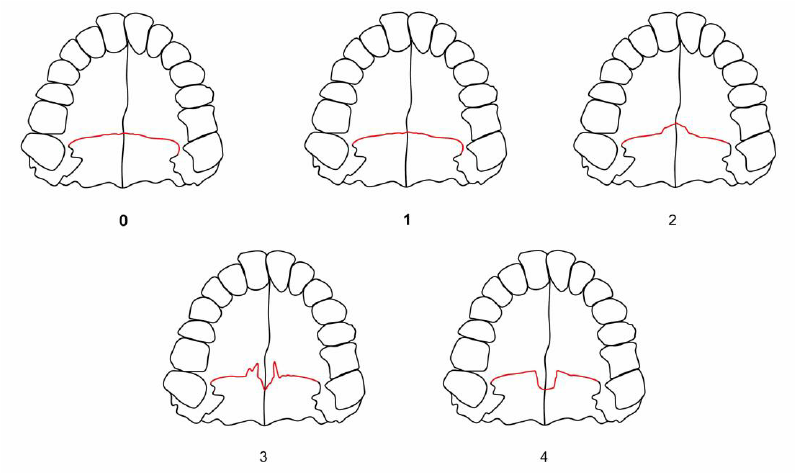 Why isn’t there an expander for these other palatal sutures? | Looksmax ...