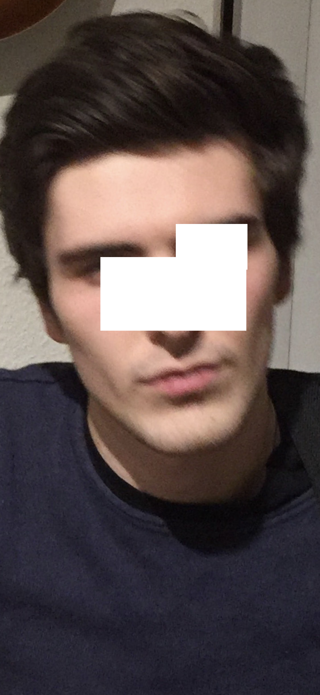 Bonesmashing | Looksmax.org - Men's Self-Improvement & Aesthetics