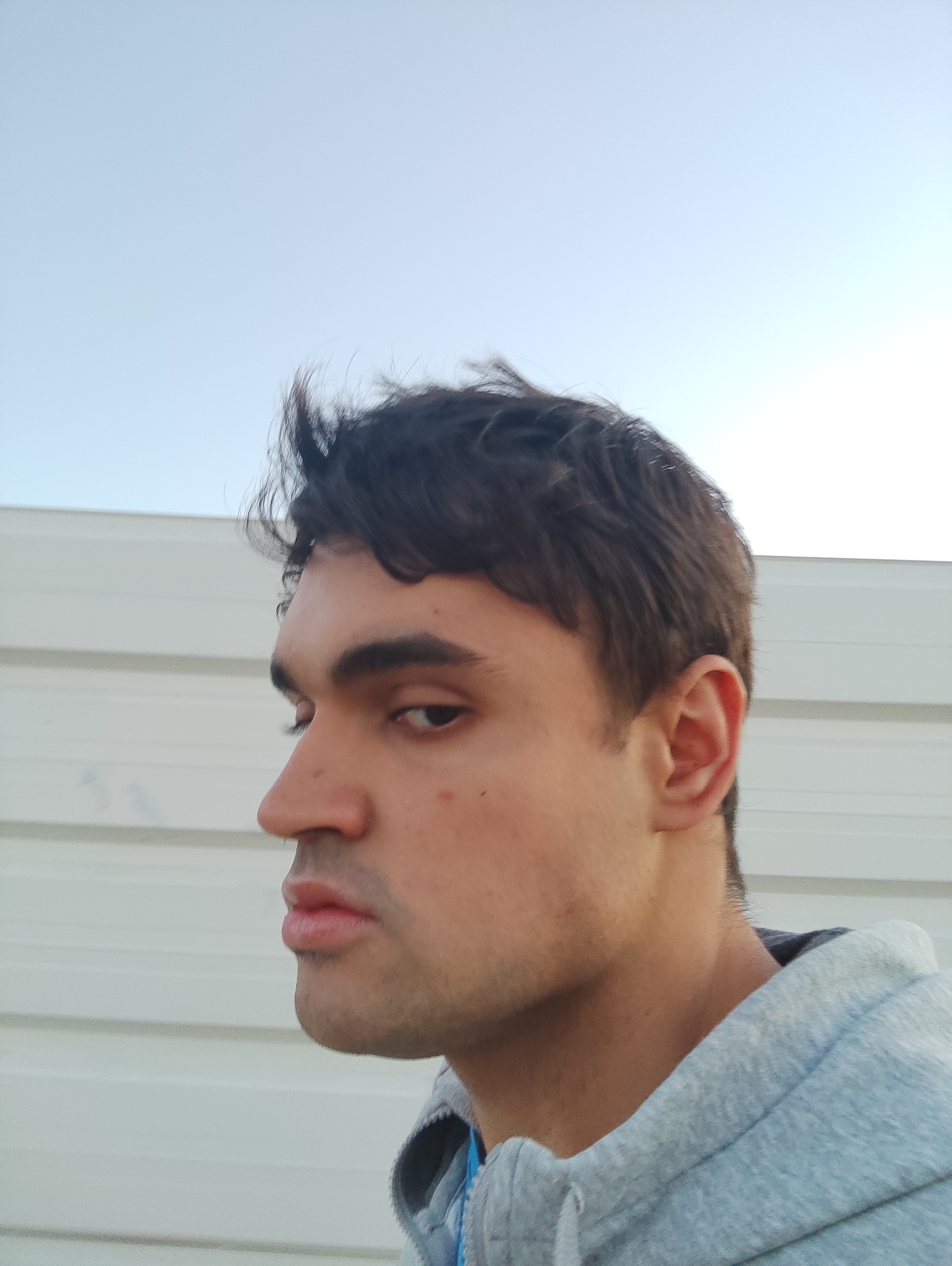 Its possible become chad with some surgerys? | Looksmax.org - Men's ...