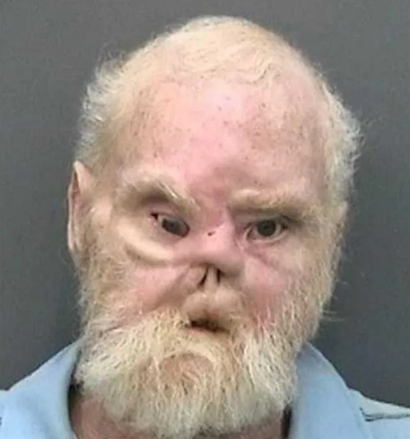 Could he be the ultimate truecel? | Looksmax.org - Men's Self ...