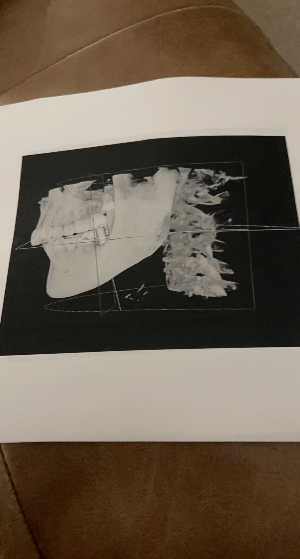 How does my CT Scan look? | Looksmax.org - Men's Self-Improvement ...
