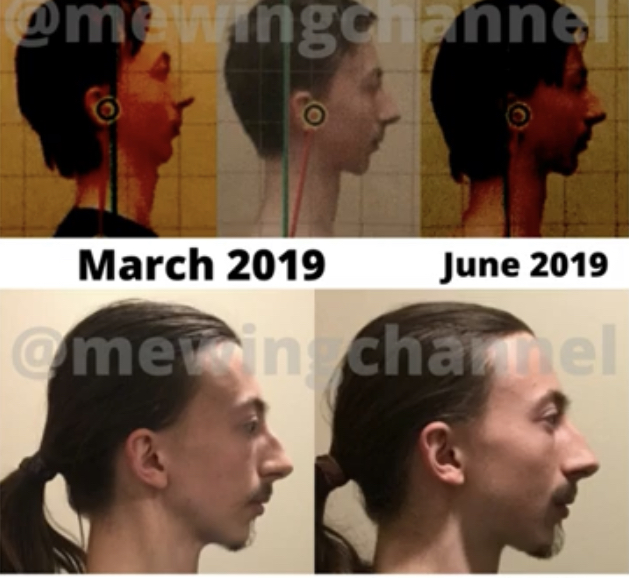 From chadlite only to chad only | Looksmax - Men's Self-Improvement ...