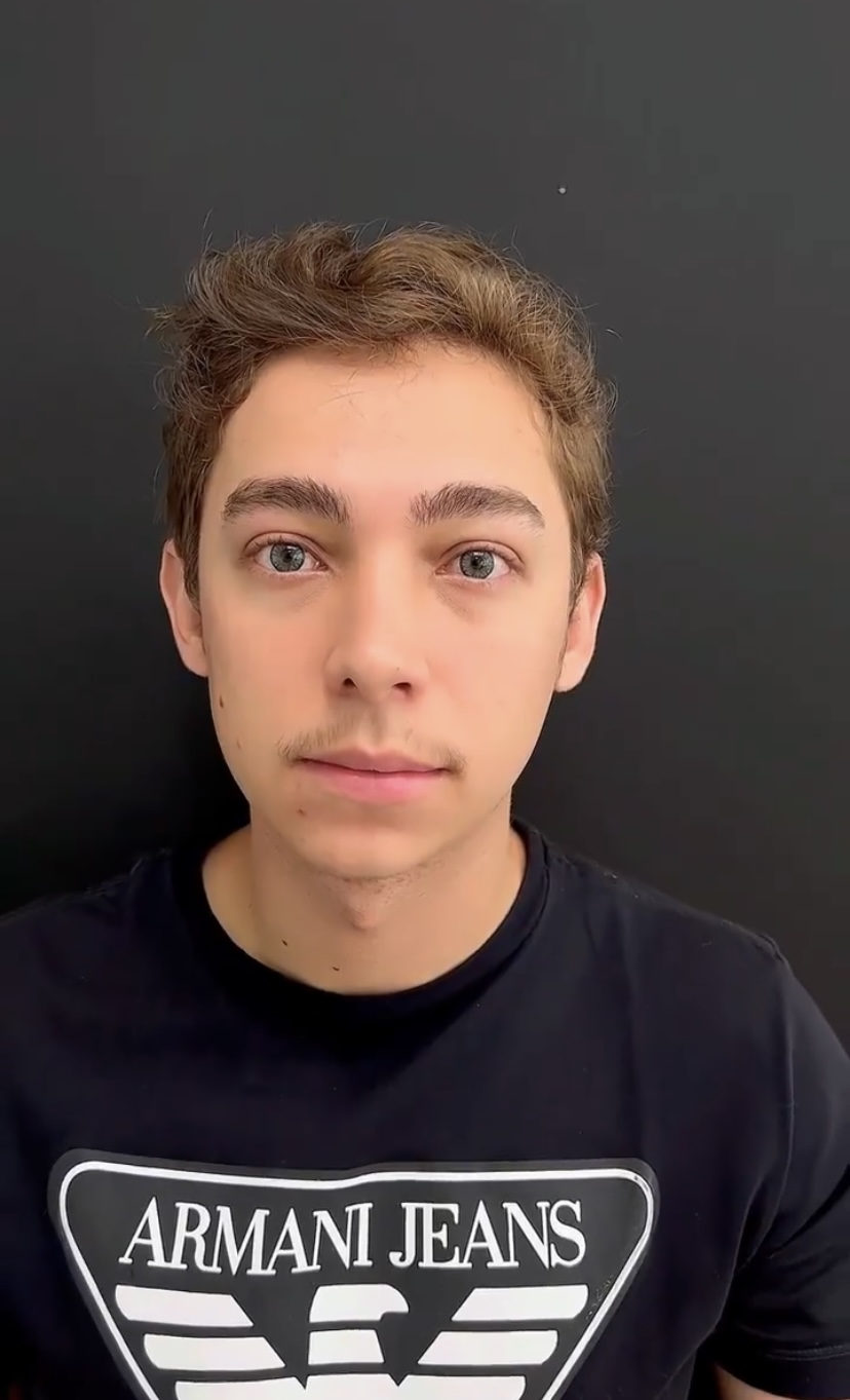Rate this chin implant transformation | Looksmax.org - Men's Self ...