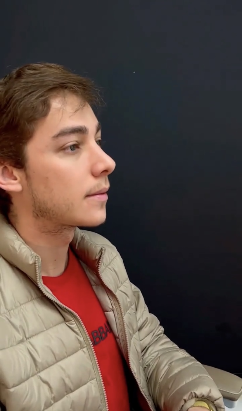 Rate this chin implant transformation | Looksmax.org - Men's Self ...
