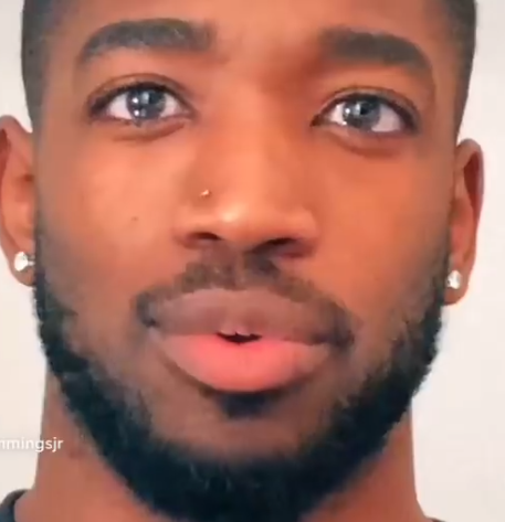 “Eyes are impossible to fix bro” “Muh Bimax is the only way to ascend ...