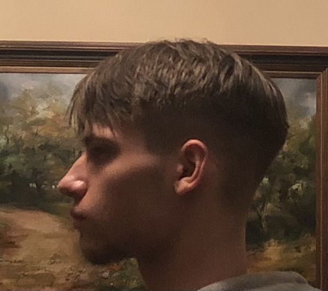Rate my side profile | Looksmax.org - Men's Self-Improvement & Aesthetics