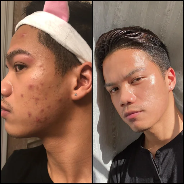 How to get glowy skin | Looksmax.org - Men's Self-Improvement & Aesthetics