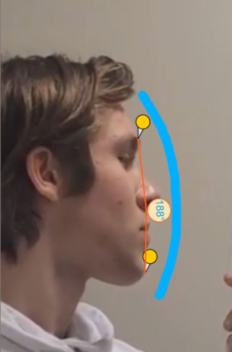 Rate my side profile on that vid | Looksmax.org - Men's Self ...