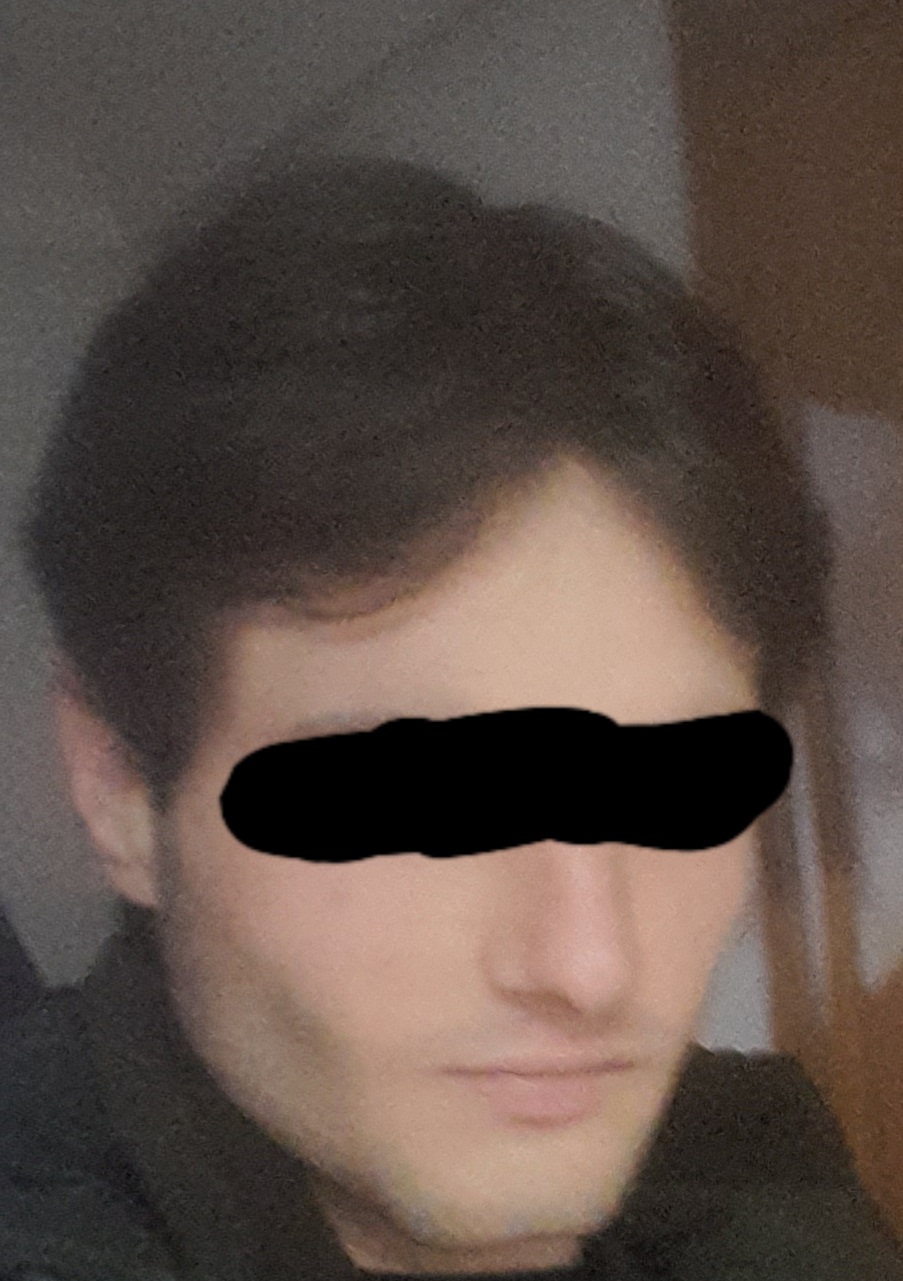 This is how a truecel looks like | Looksmax.org - Men's Self ...