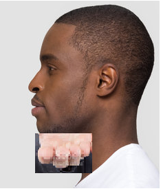 Whats the ideal forward growth of a jaw in cm? | Looksmax.org - Men's ...