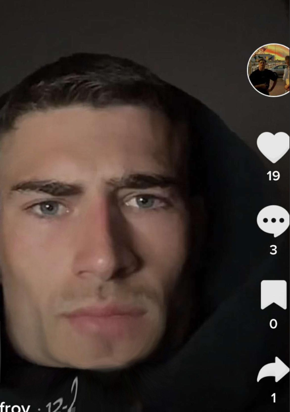 Big chin/tall chin/projecting chin is COPE for guys ... Doesn't make ...