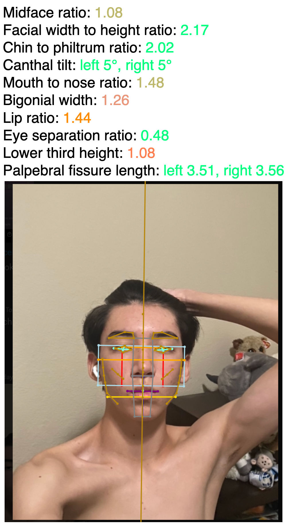 Is it over for my midface ratio | Looksmax.org - Men's Self-Improvement ...