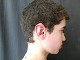 14 Male 6'3 | Rate my side profile | is it over? | Looksmax - Men's ...