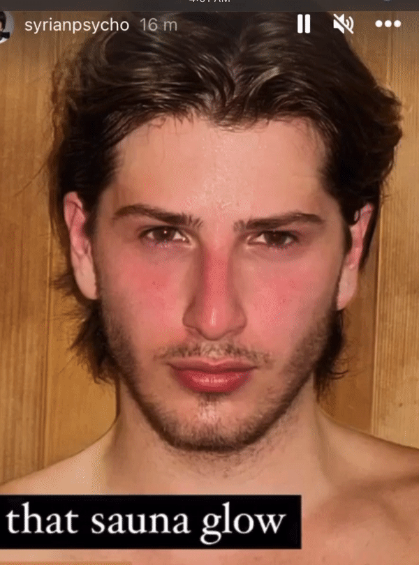 Syrianpsycho ratios are fucked | Looksmax.org - Men's Self-Improvement ...