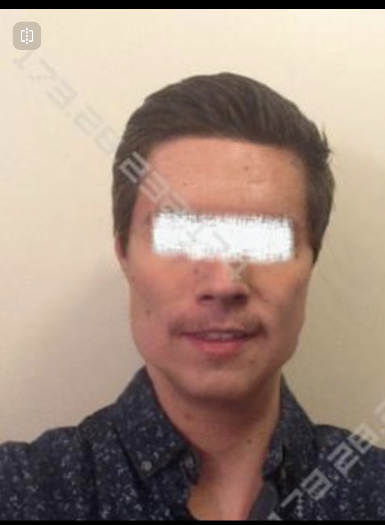 Wide face is a huge failo if ur gonions are inward | Looksmax.org - Men ...