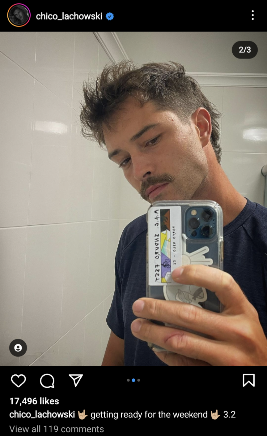 Chico is no longer a chad. age pill is brutal. Its over for him ...