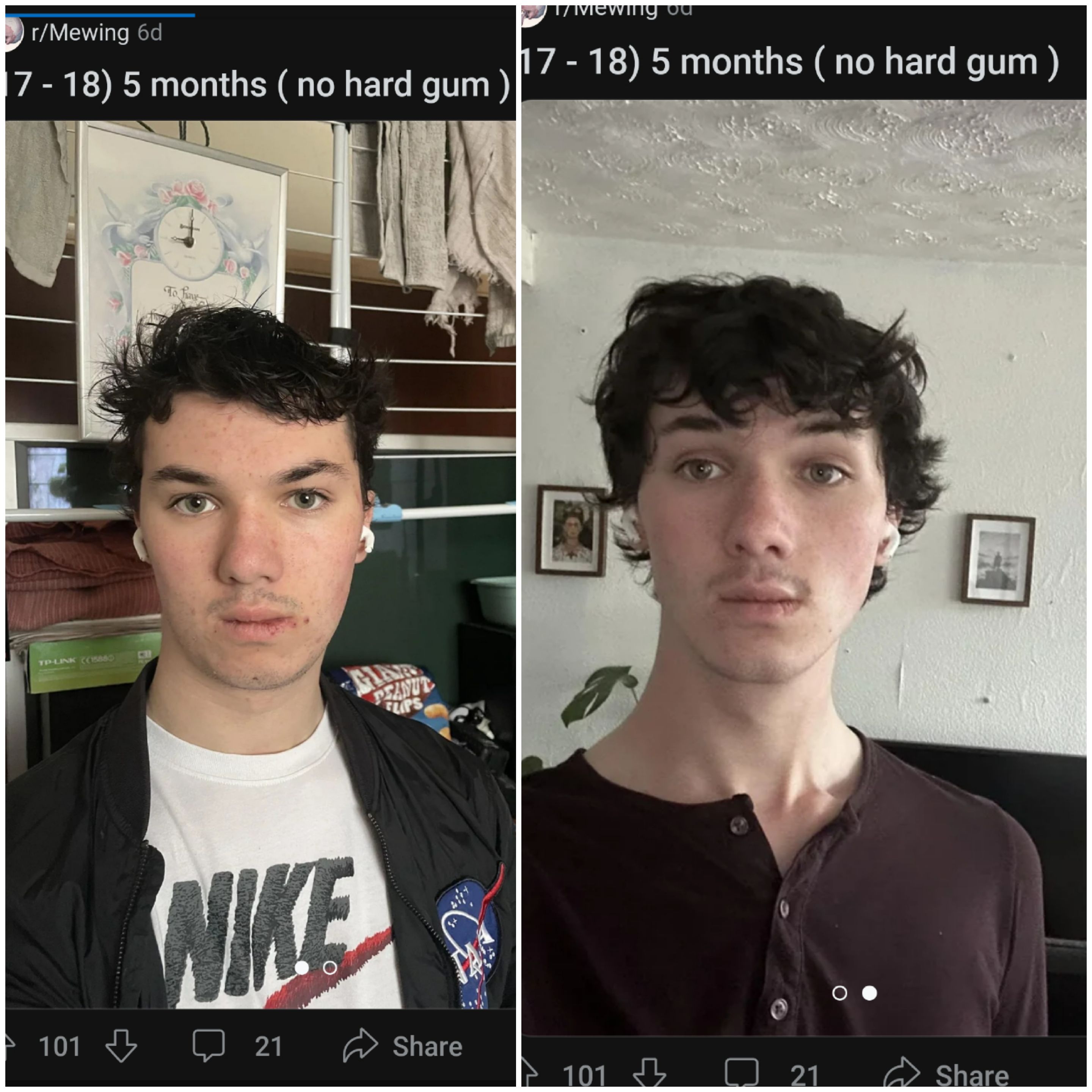 Man becomes chad in 5 months thanks to mewing | Looksmax.org - Men's ...