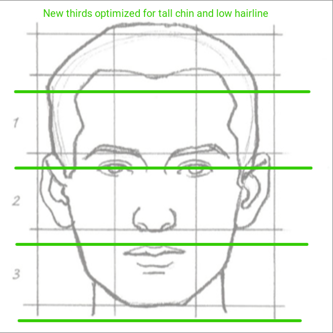 Tall Chin Lower Third Theory | Re-Evaluating The Concept of 3 Equal ...