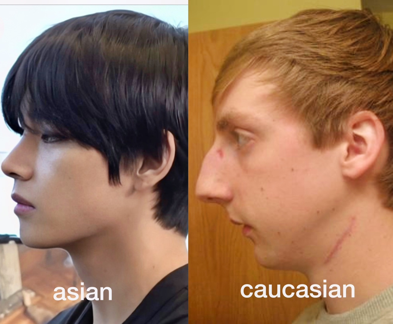 Learn the differences between asians and caucasians guys | Looksmax.org ...