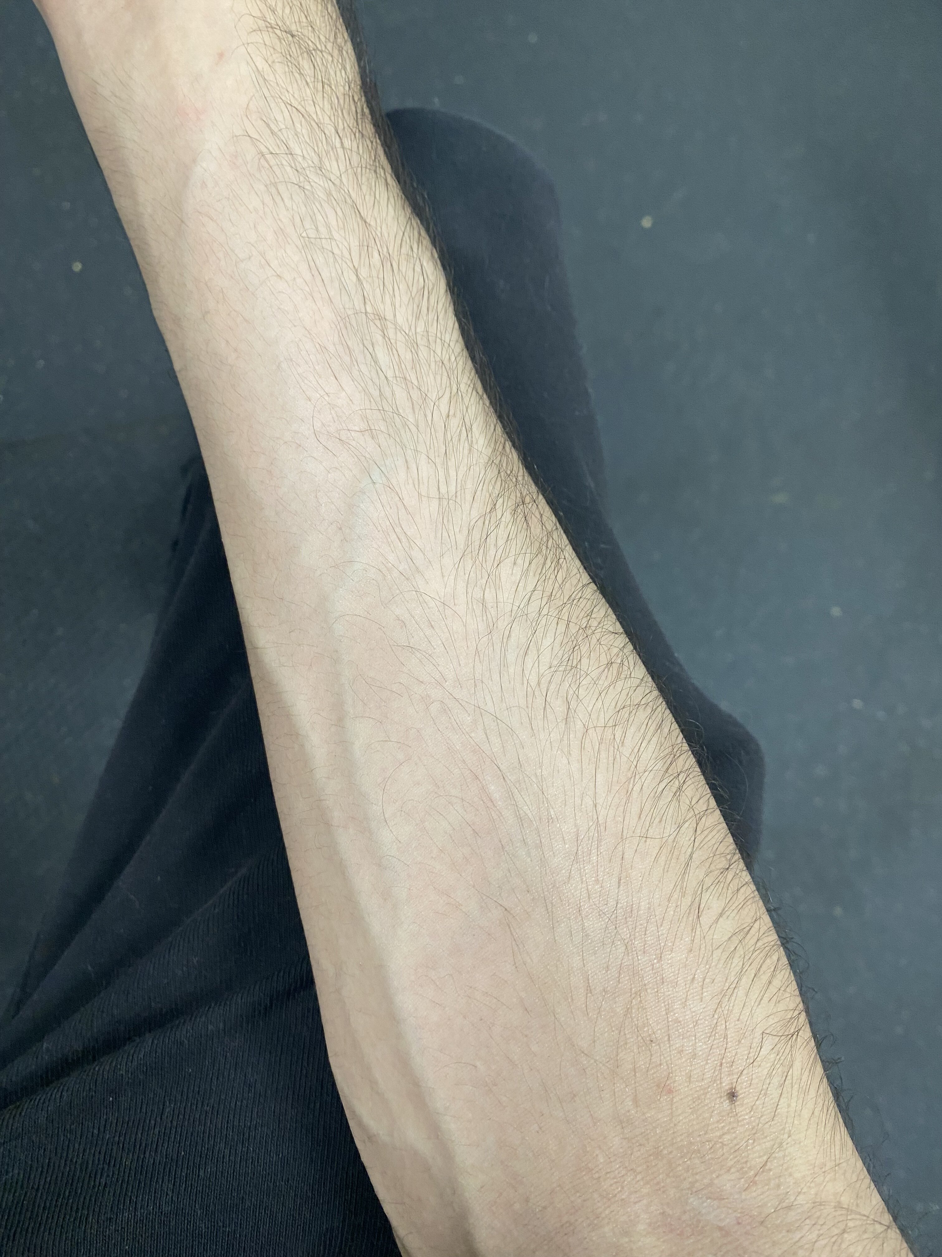 How do I fix this CADAVER LIKE skin undertone? | Looksmax.org - Men's ...