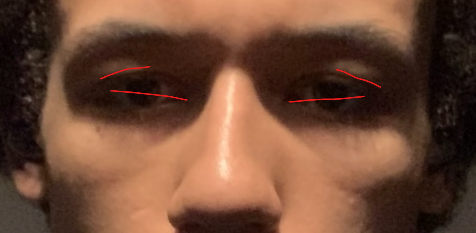 Why are my orbitals compact but my eye area incel tier | Looksmax - Men ...