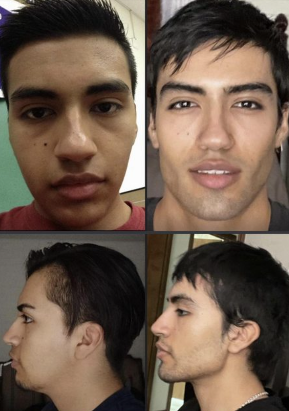 mewing is the only worthwhile looksmax | Looksmax.org - Men's Self ...