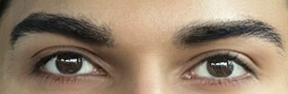 Eye surgery morph advice | Looksmax.org - Men's Self-Improvement ...