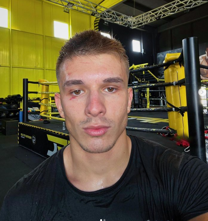 Boxingmaxxing for looks | Looksmax.org - Men's Self-Improvement ...