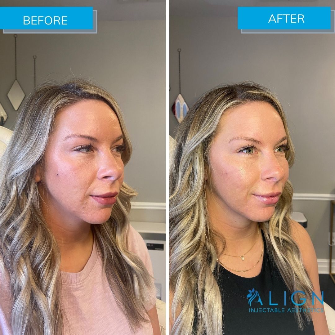 Rate Stacy Transformation | Looksmax.org - Men's Self-Improvement ...