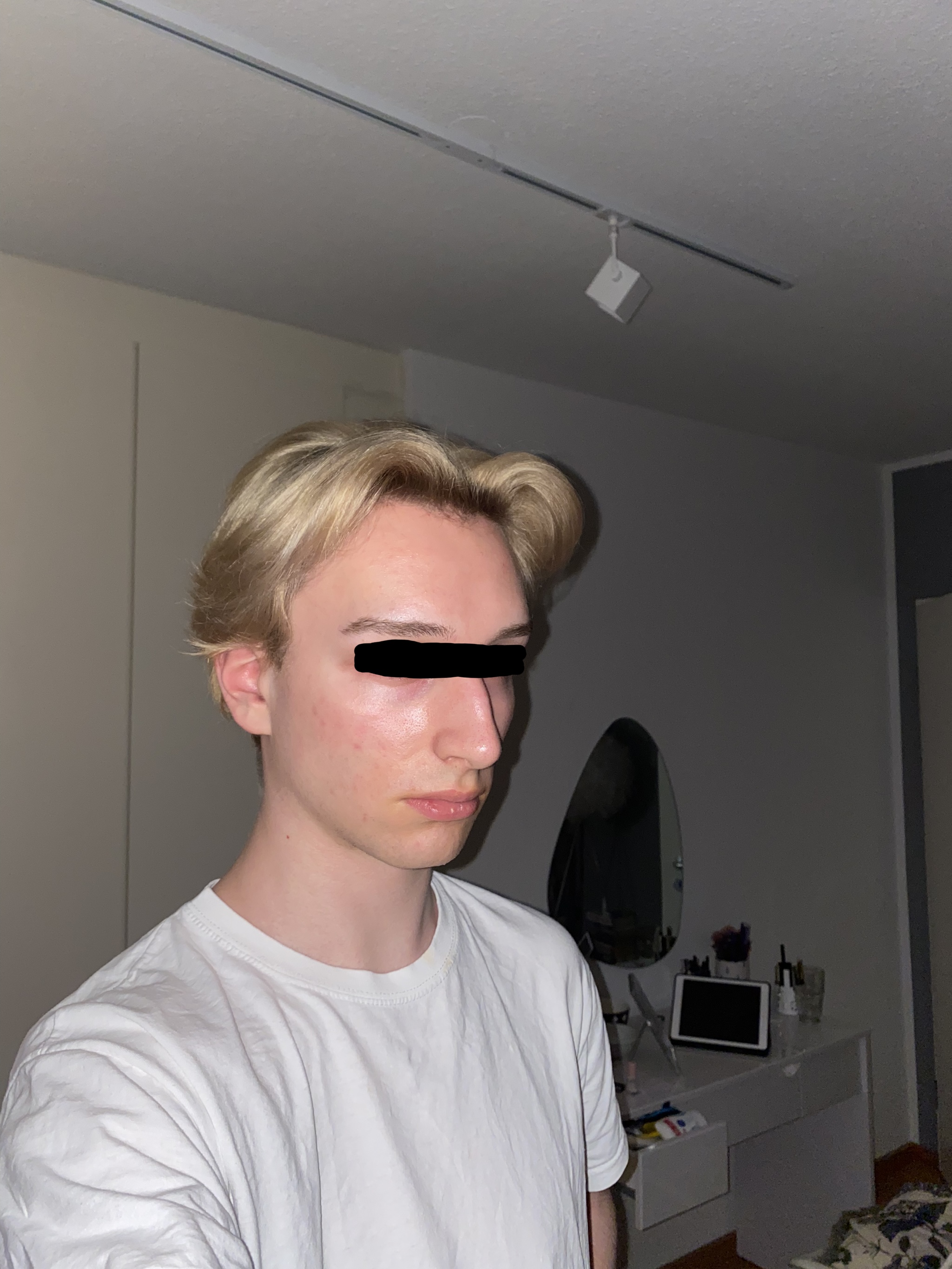 My skull is so asymmetrical that I look like two different people from ...