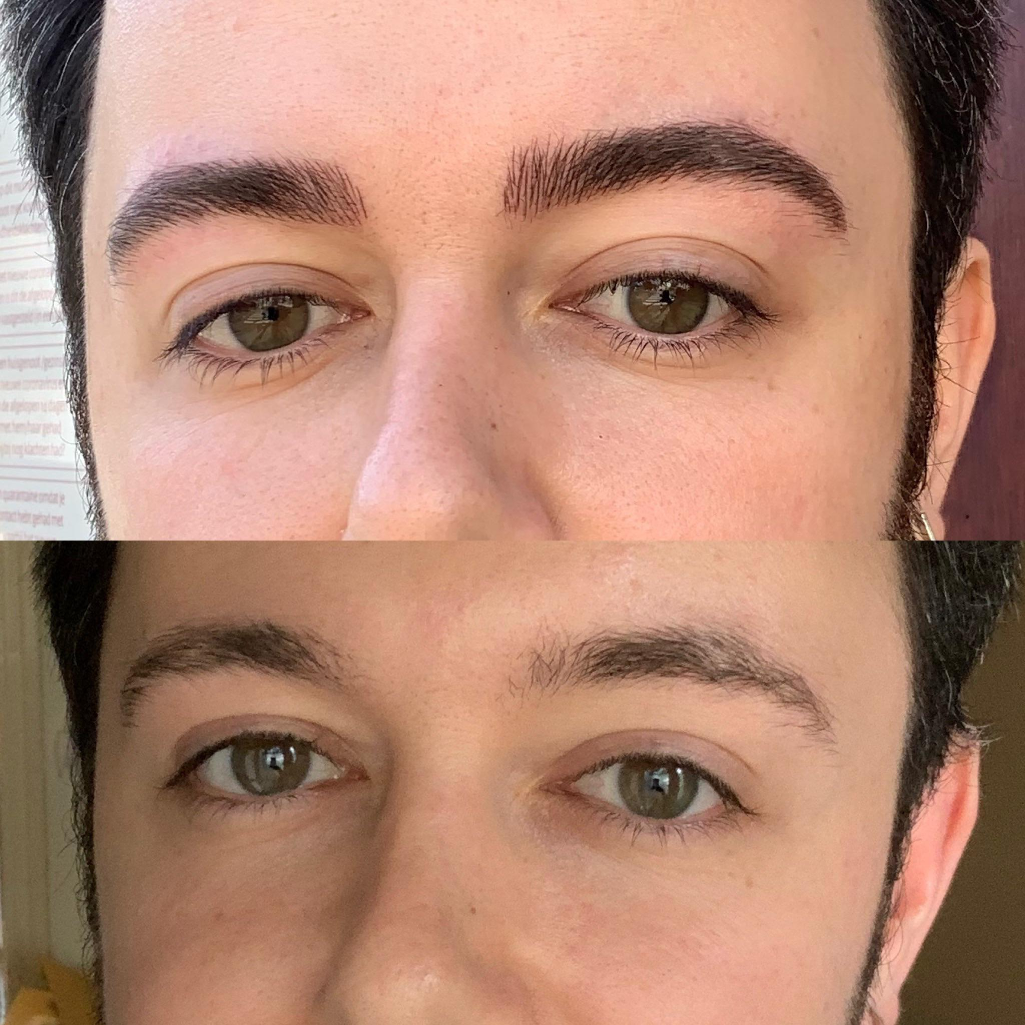 all possible means to enhance eyebrow growth | Looksmax.org - Men's ...