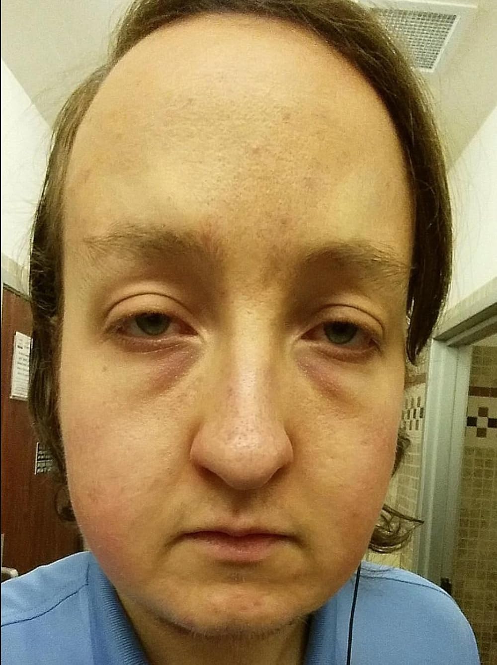 Psl rating examples | Incels.is - Involuntary Celibate Forum