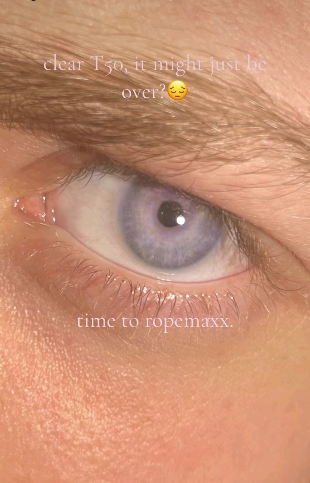 Is it A10 eye? | Looksmax.org - Men's Self-Improvement & Aesthetics