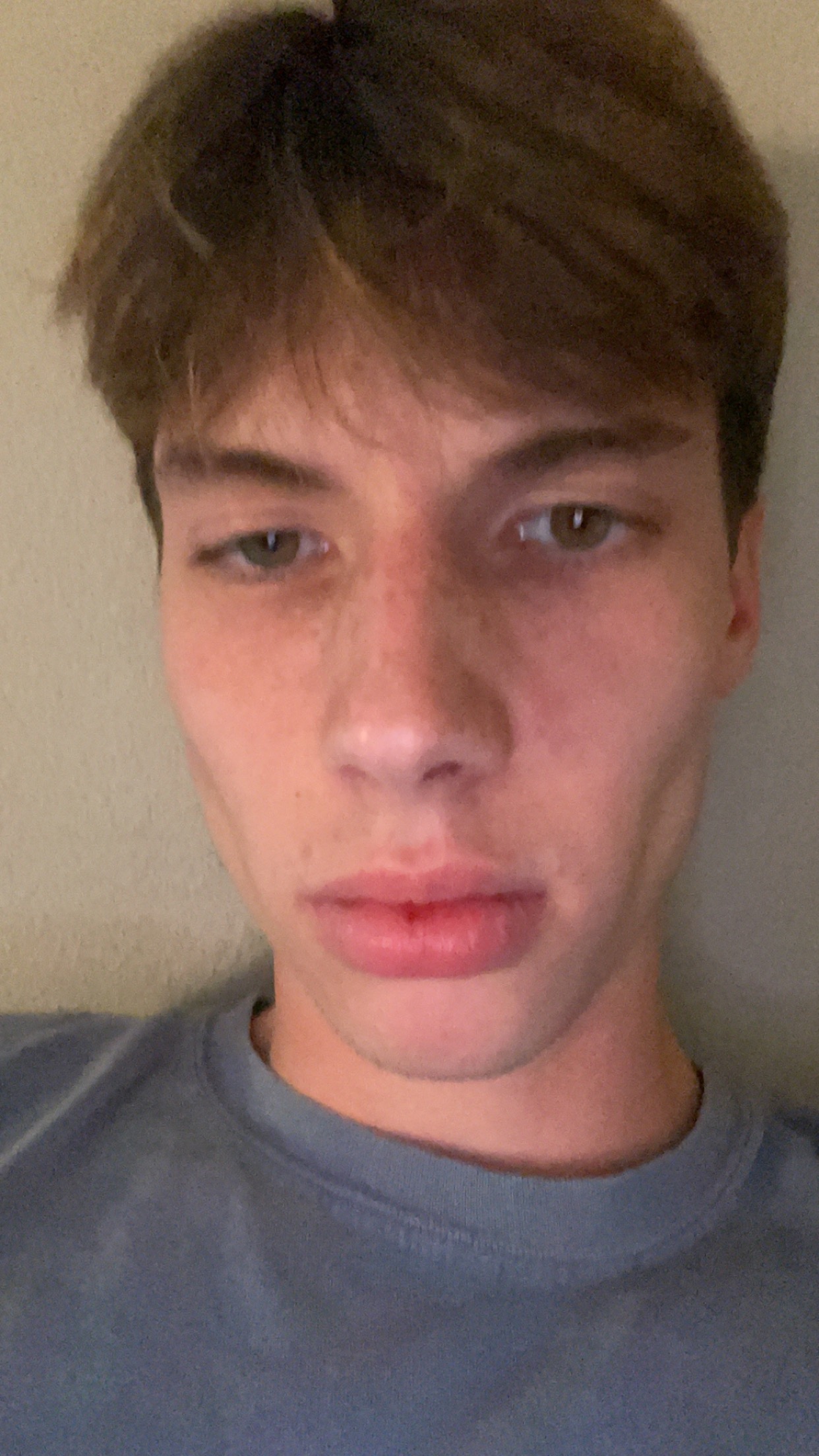 How recessed am I? | Looksmax.org - Men's Self-Improvement & Aesthetics
